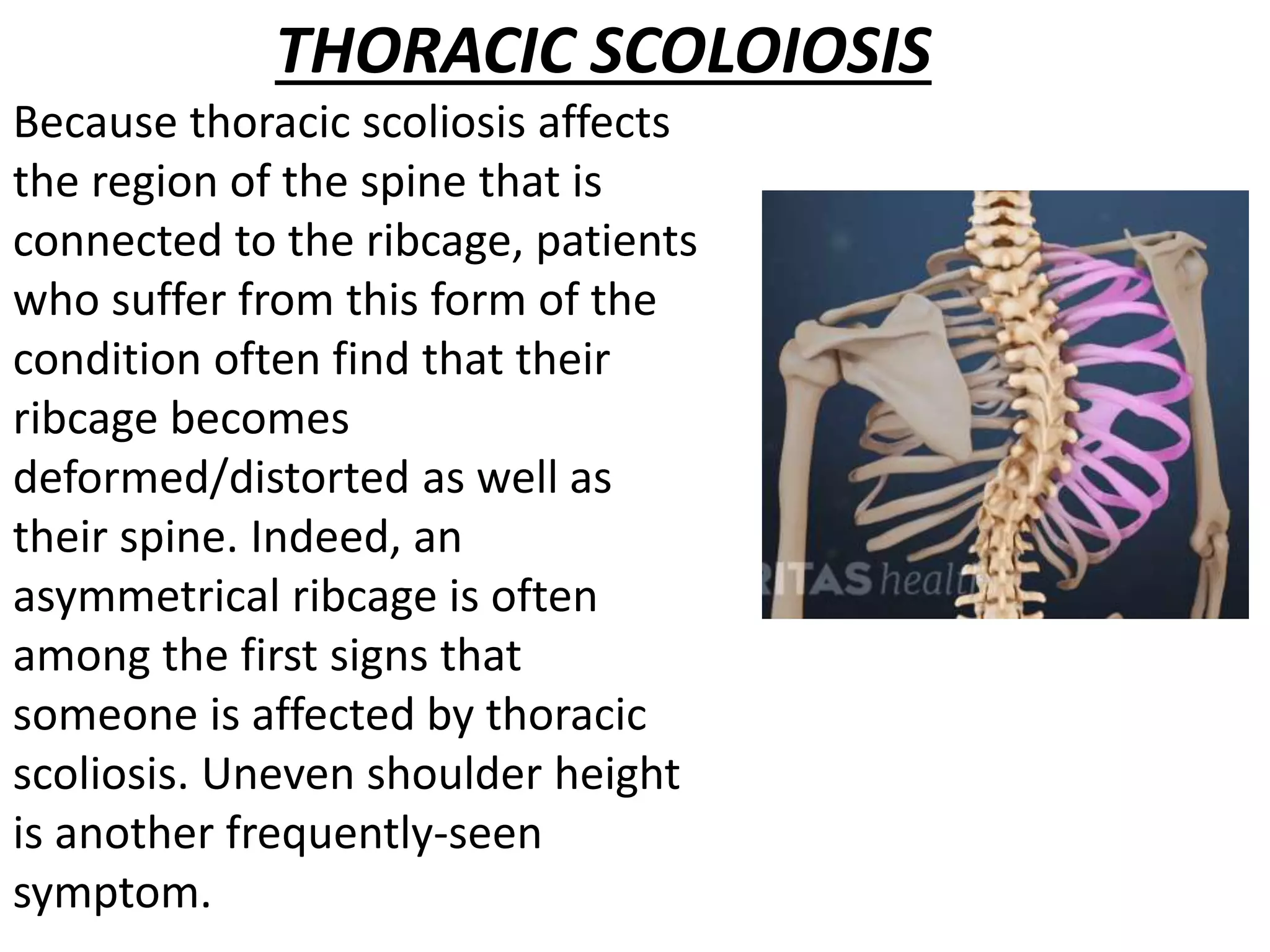 Biomechanics of thoracic spine ppt | PPT