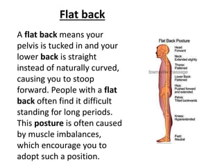 Biomechanics of thoracic spine ppt @Dr.Muskan Rastogi (PT) BPT,MPT(OBG ...