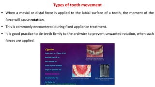 Biomechanics of Tooth Movement.pdf