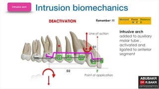 Biomechanics of Tooth Movement.pdf