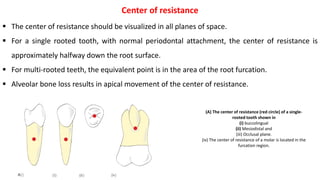 Biomechanics of Tooth Movement.pdf