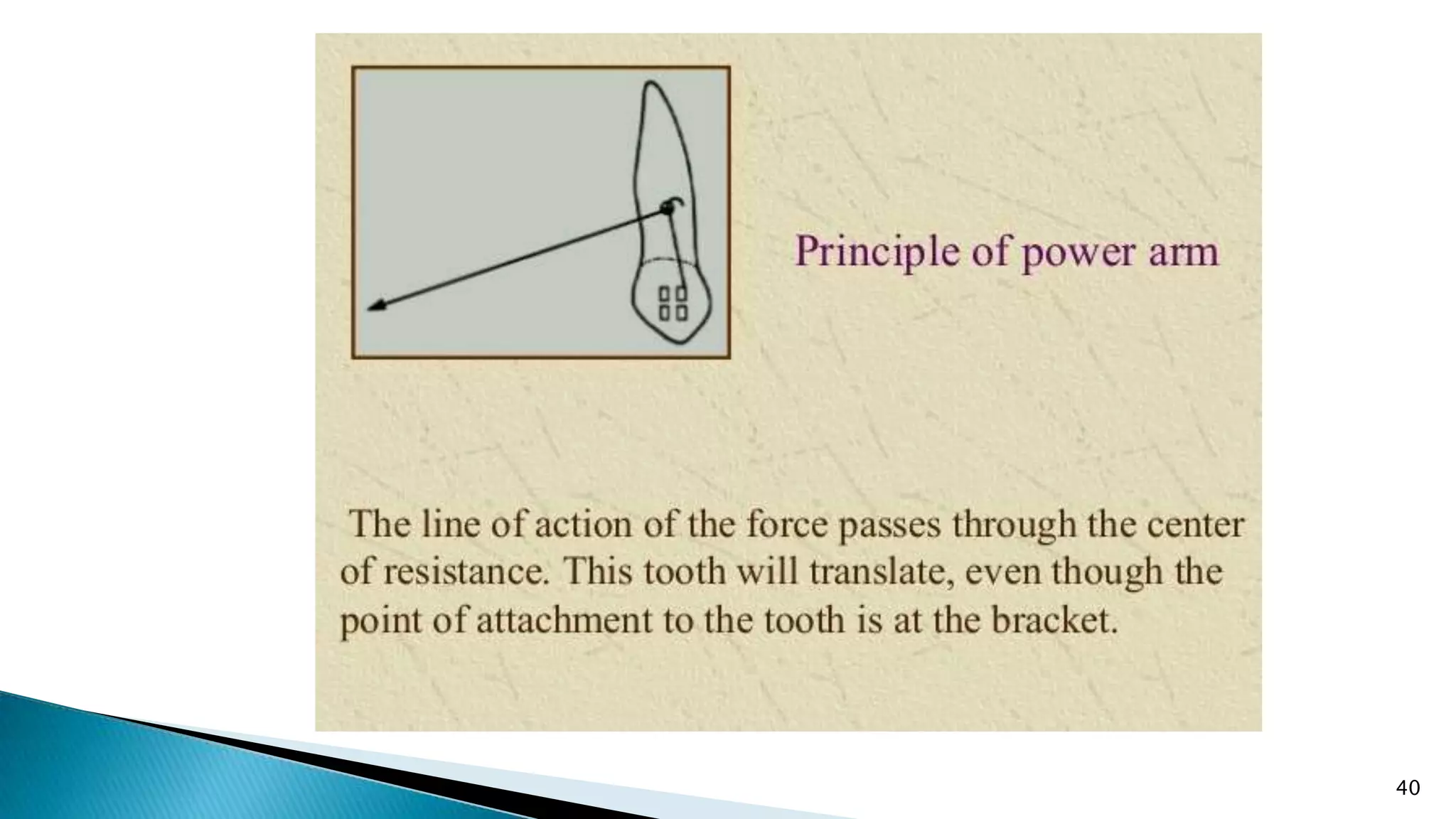 Orthodontic tooth movements and biomechanics. | PPTX