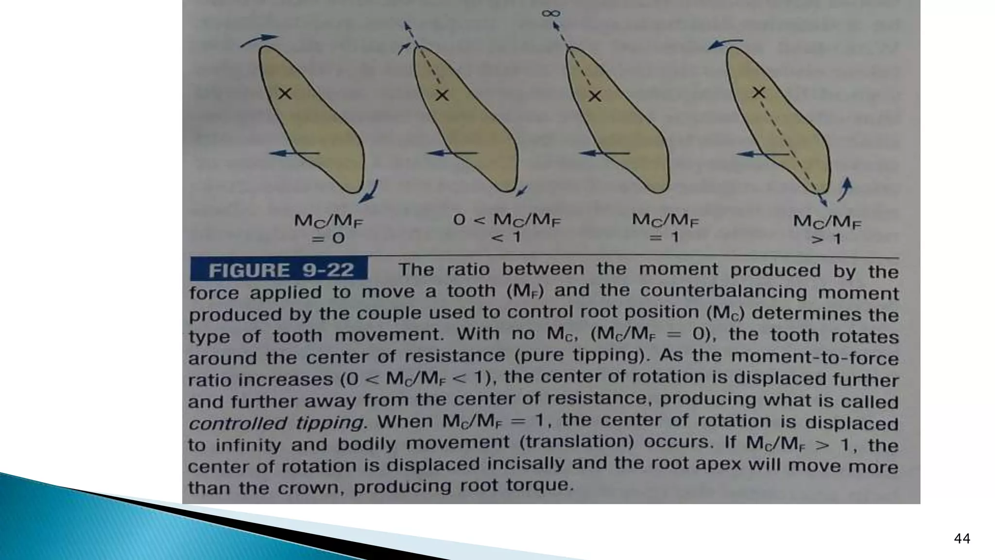 Orthodontic tooth movements and biomechanics. | PPTX