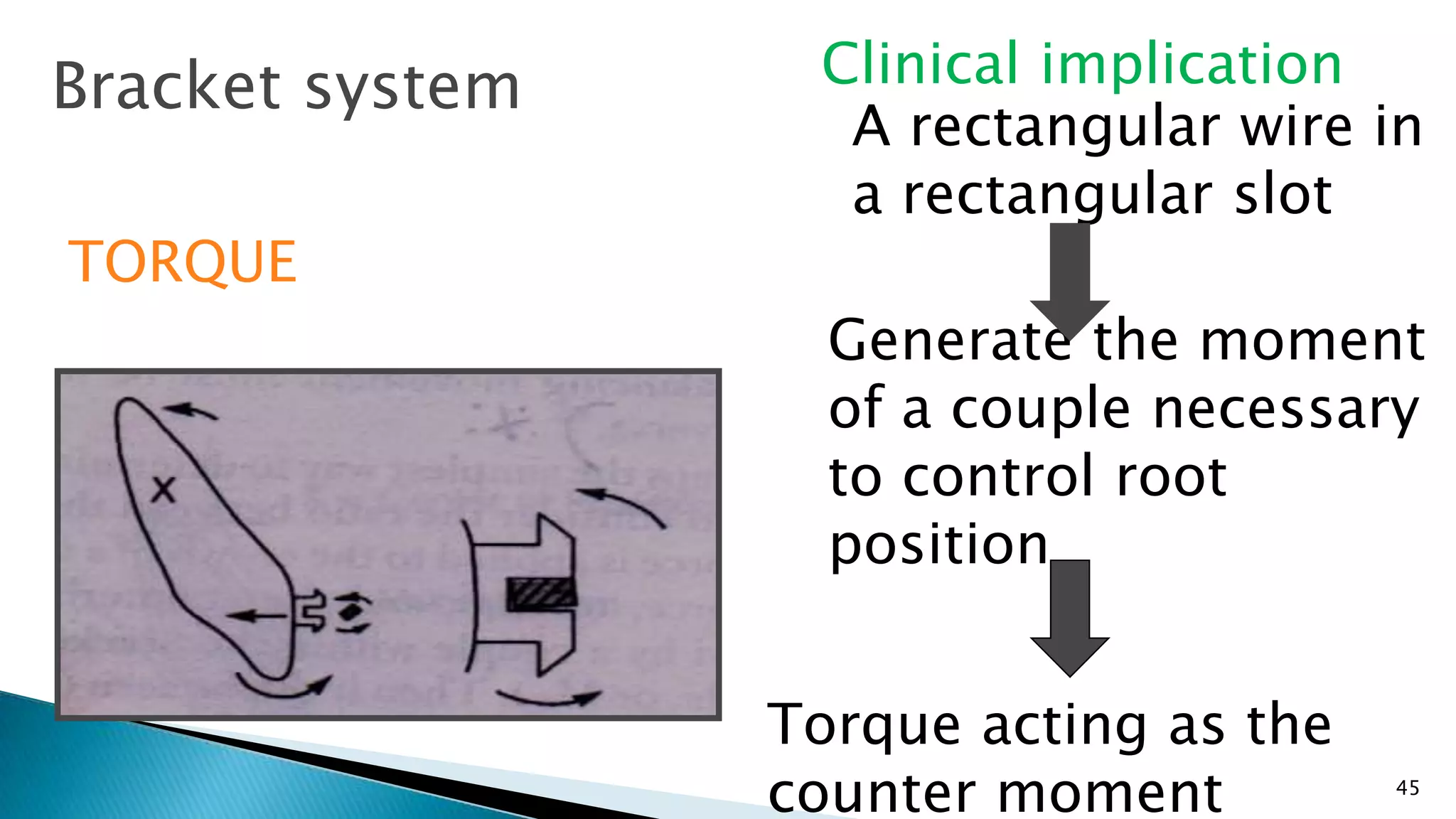 Orthodontic tooth movements and biomechanics. | PPTX