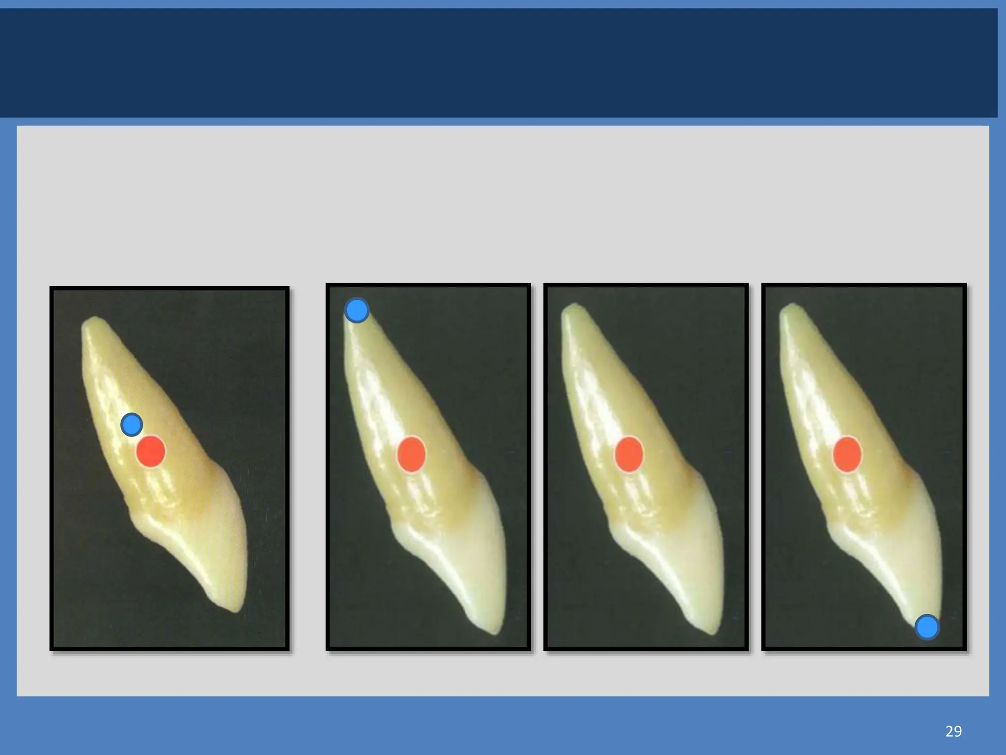 Biomechanics iin of tooth movements.pptx