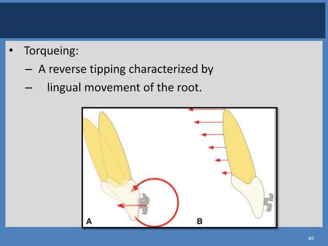Biomechanics iin of tooth movements.pptx