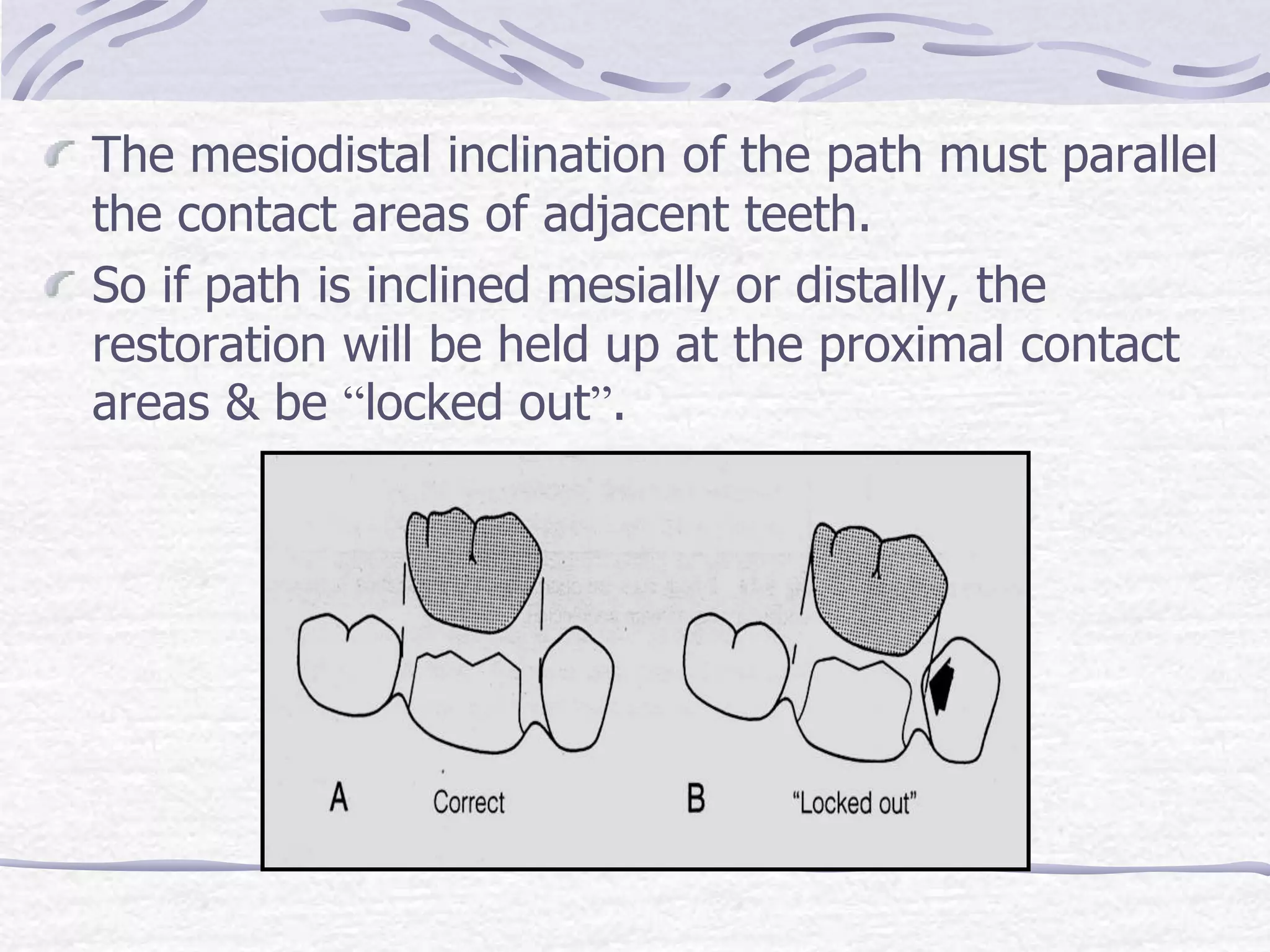 BIOMECHANICS OF TOOTH PREPARATION.ppt