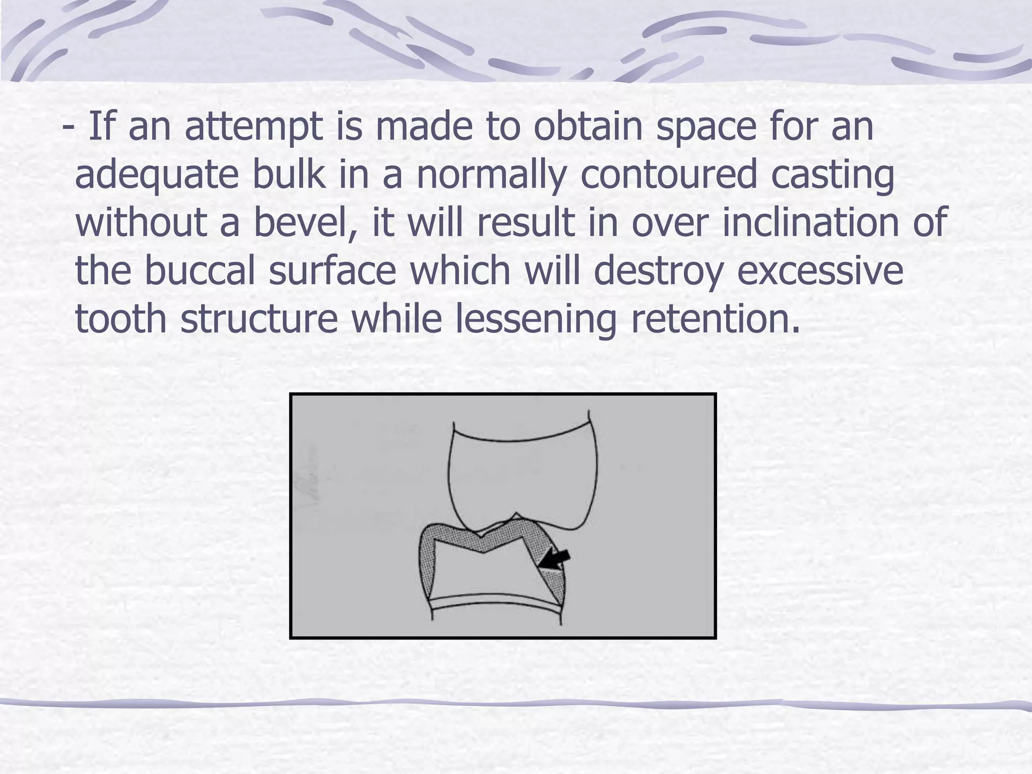 BIOMECHANICS OF TOOTH PREPARATION.ppt