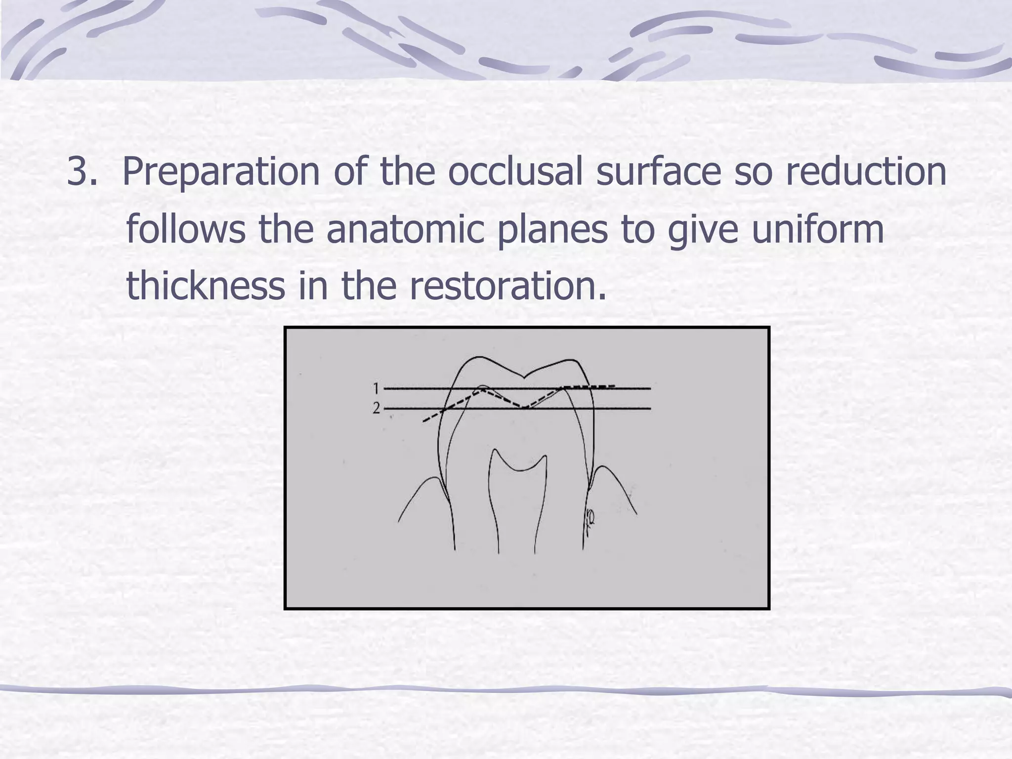 BIOMECHANICS OF TOOTH PREPARATION.ppt