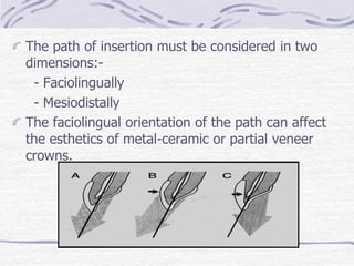 BIOMECHANICS OF TOOTH PREPARATION.ppt