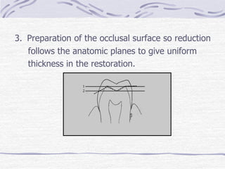 BIOMECHANICS OF TOOTH PREPARATION.ppt