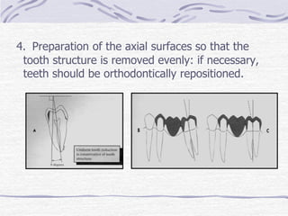 BIOMECHANICS OF TOOTH PREPARATION.ppt