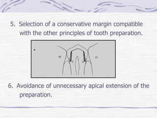 BIOMECHANICS OF TOOTH PREPARATION.ppt
