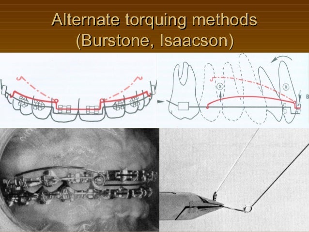 Biomechanics of torque control