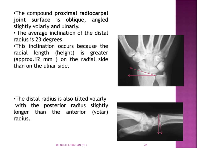 Biomechanics of wrist complex | PPTX