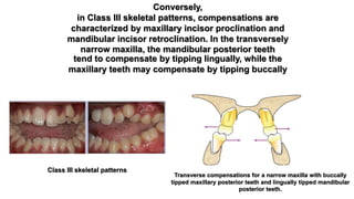 Biomechanics and treatment of dentofacial deformities part 1 | PPTX