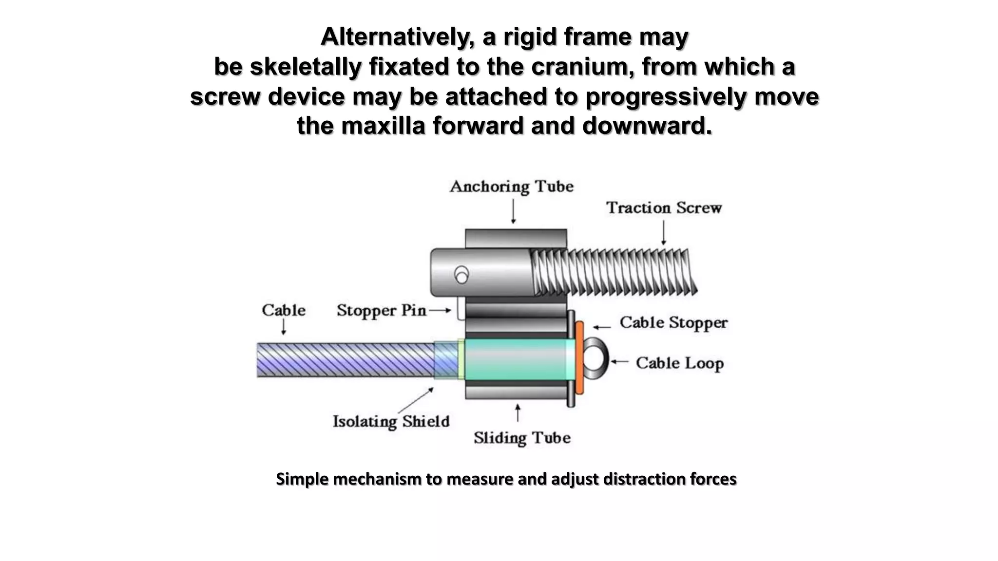 orthodontic biomechanics of skeleta deformities part 3 | PPTX