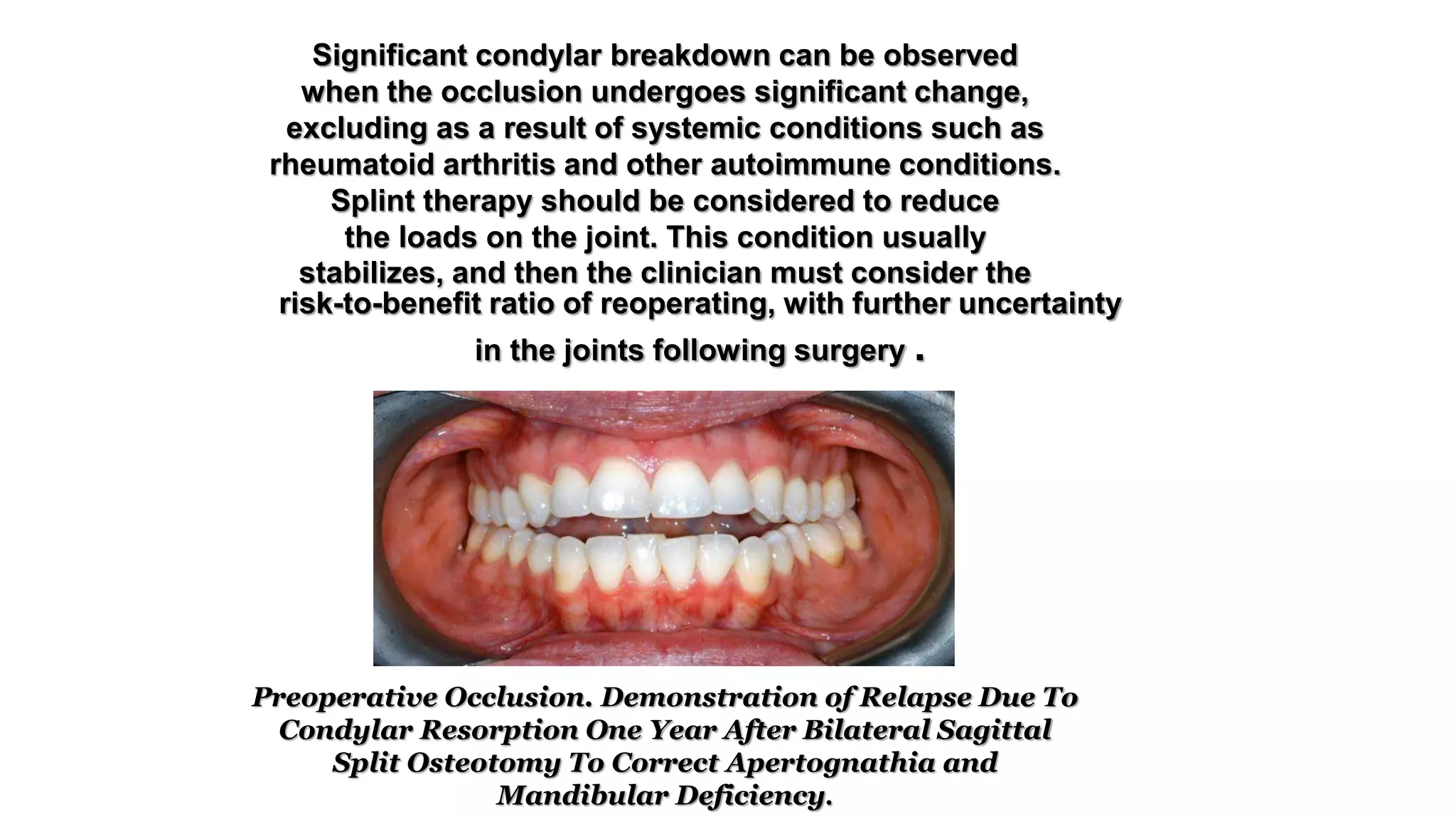 orthodontic biomechanics of skeleta deformities part 3 | PPTX