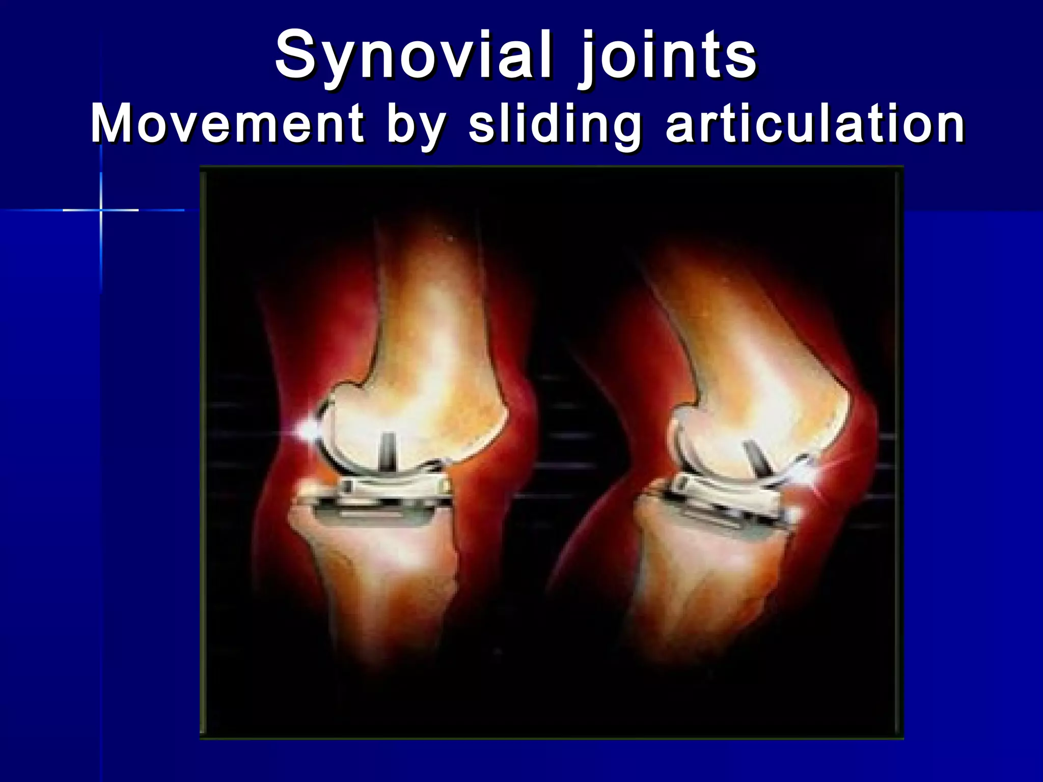 Biomech of cerv disk medium | PPT