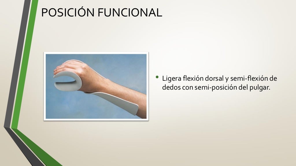 Biomecánica de la muñeca