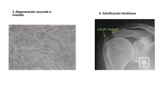 Biomecánica del tendón.pptx