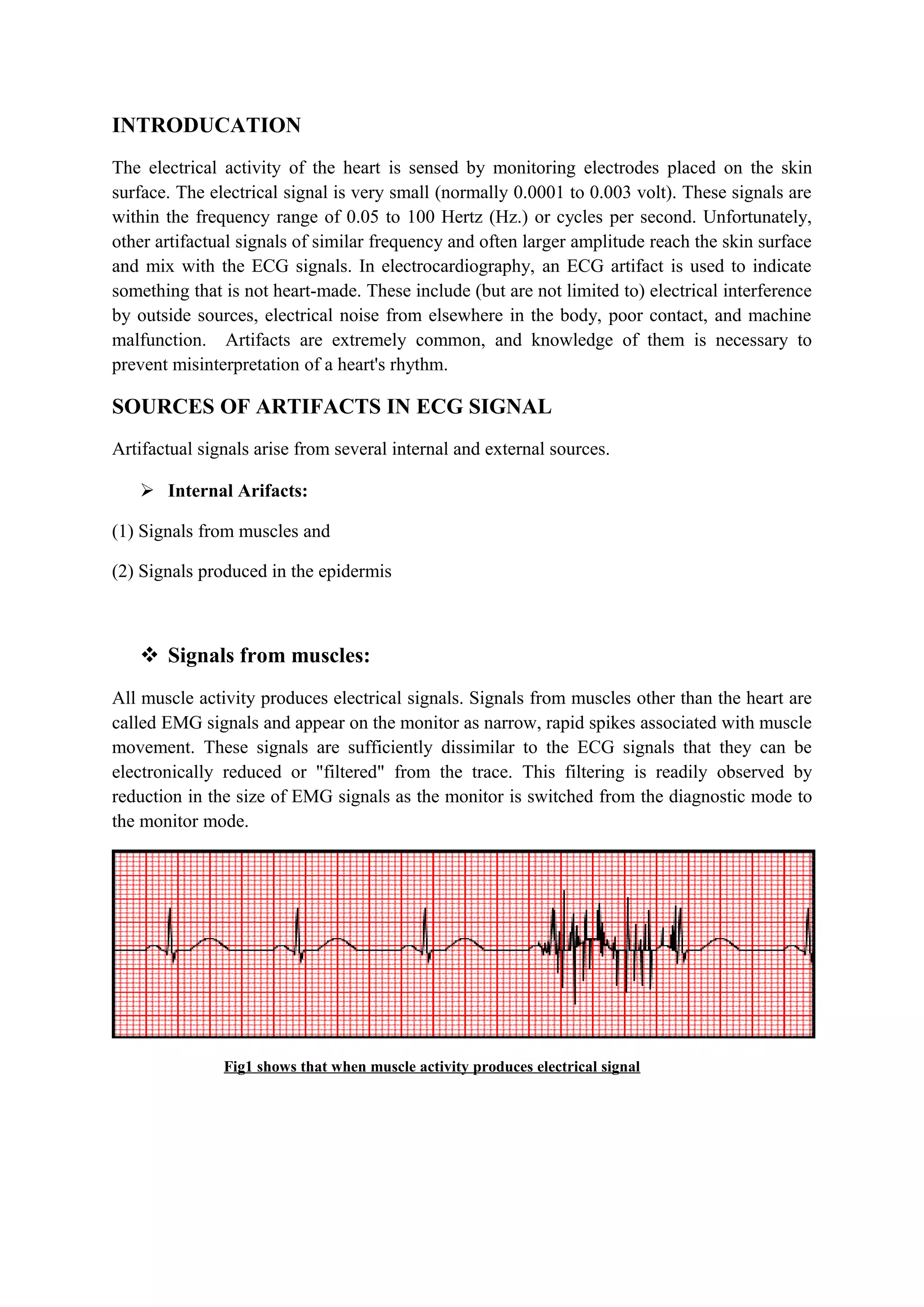 various type of artifacts in ECG signal & how it's remove | DOC