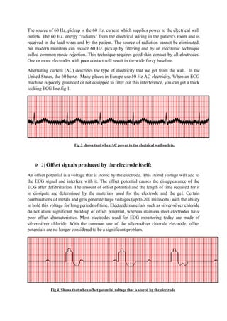 various type of artifacts in ECG signal & how it's remove | DOC