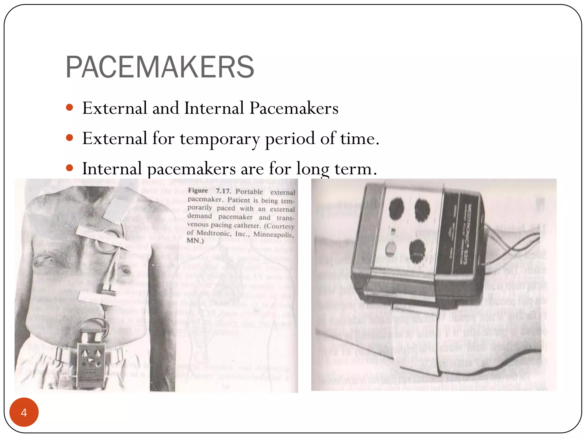 Biomedical equipments- Pacemakers and Defibrillators | PDF