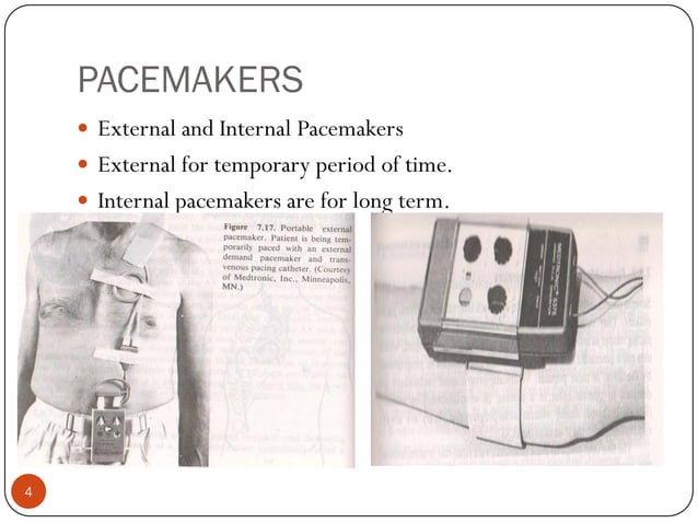 Biomedical equipments- Pacemakers and Defibrillators | PPT