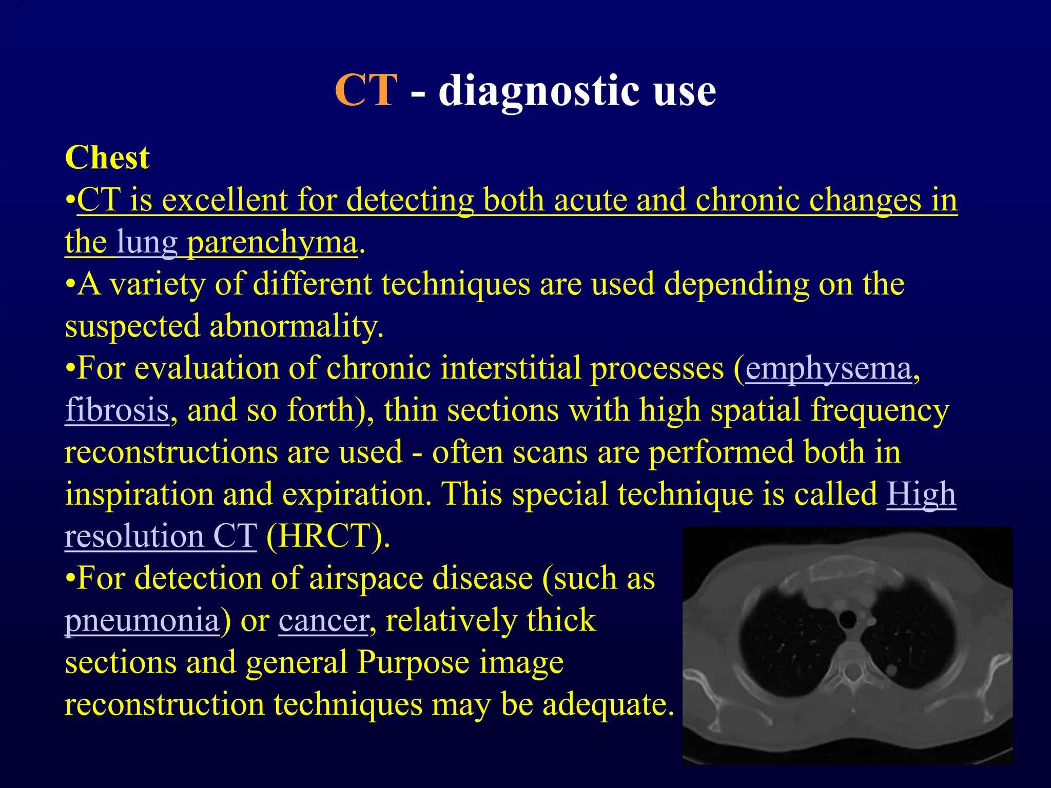 Single Positron Emission Computed Tomography (SPECT) | PPT