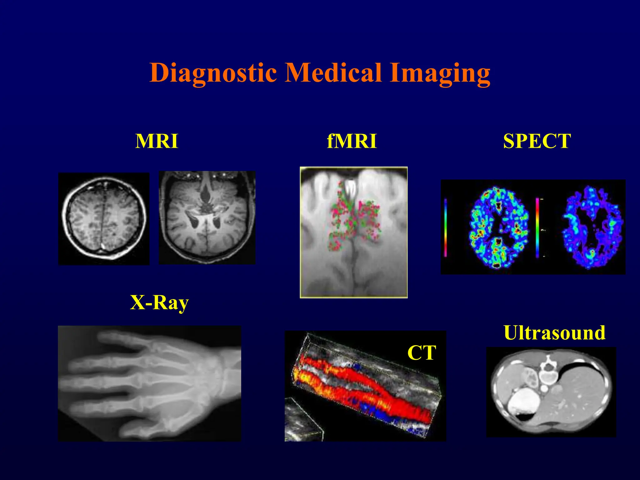 Single Positron Emission Computed Tomography (SPECT) | PPT