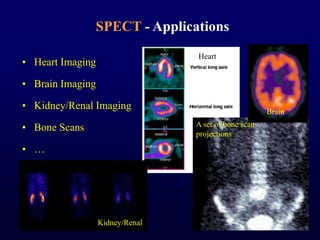 Single Positron Emission Computed Tomography (SPECT) | PPT