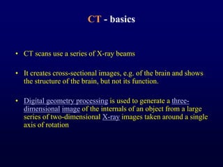 Single Positron Emission Computed Tomography (SPECT) | PPT