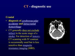 Single Positron Emission Computed Tomography (SPECT) | PPT