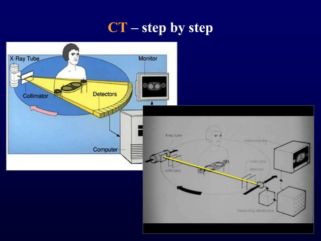 Single Positron Emission Computed Tomography (SPECT) | PPT