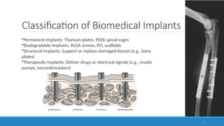Advanced Biomedical Implants polymers.pptx