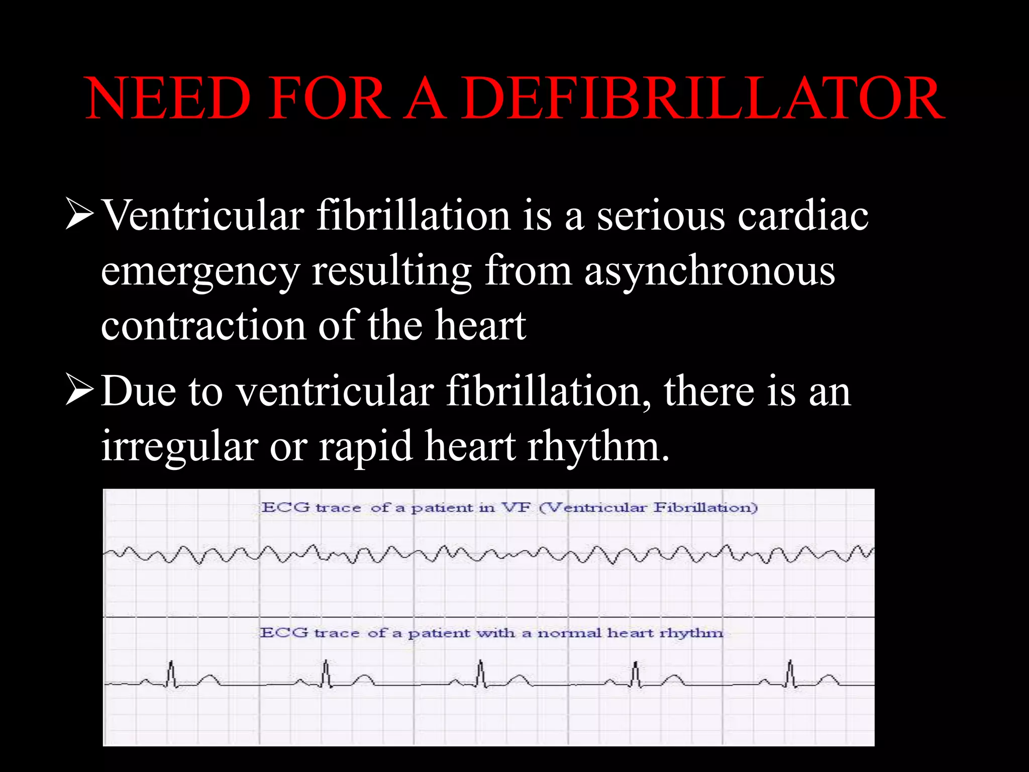 Defibrillators | PPTX