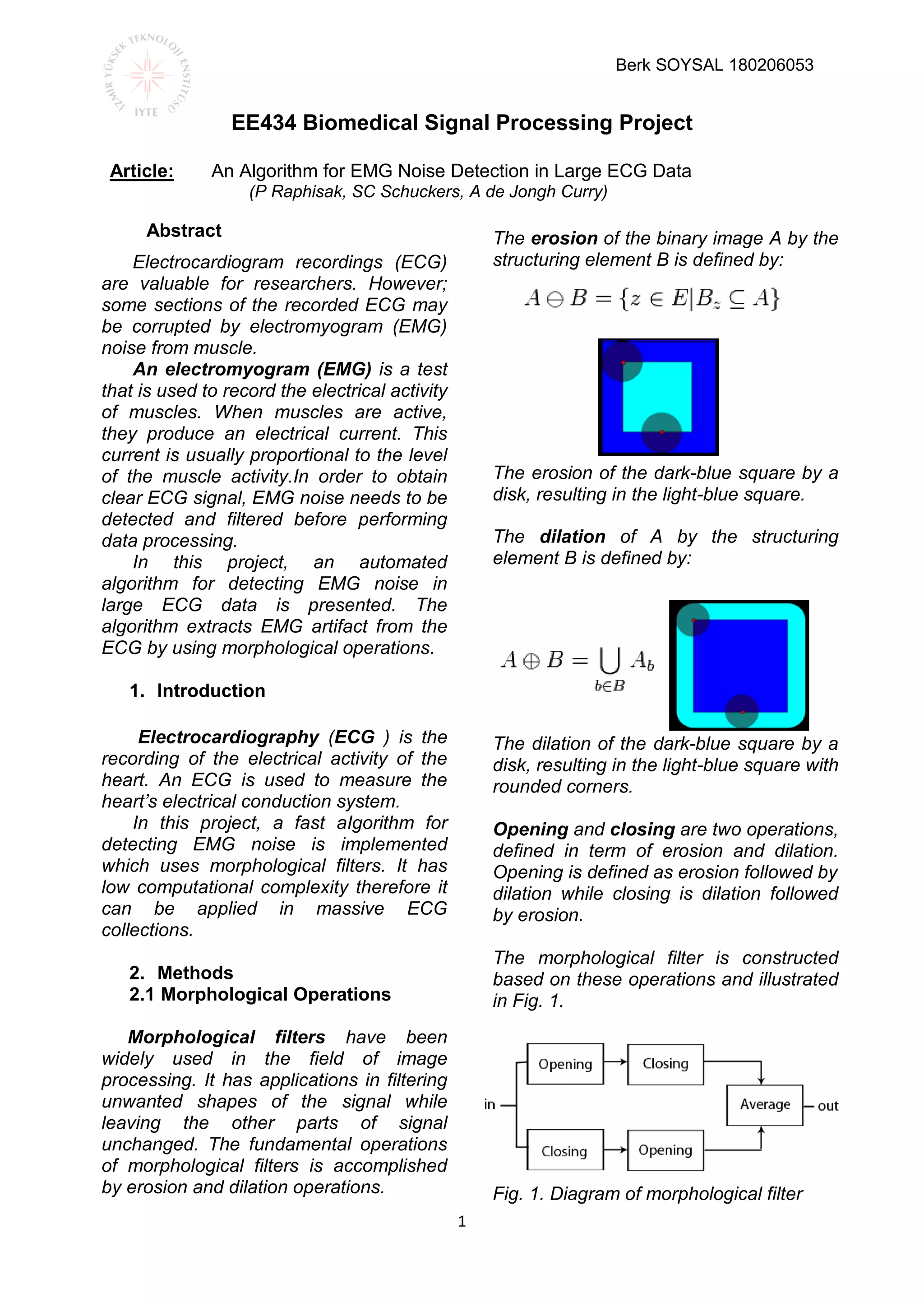 Biomedical project report detecting emg noise | PDF