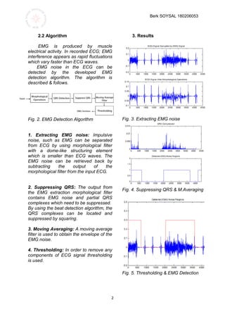 Biomedical project report detecting emg noise | PDF