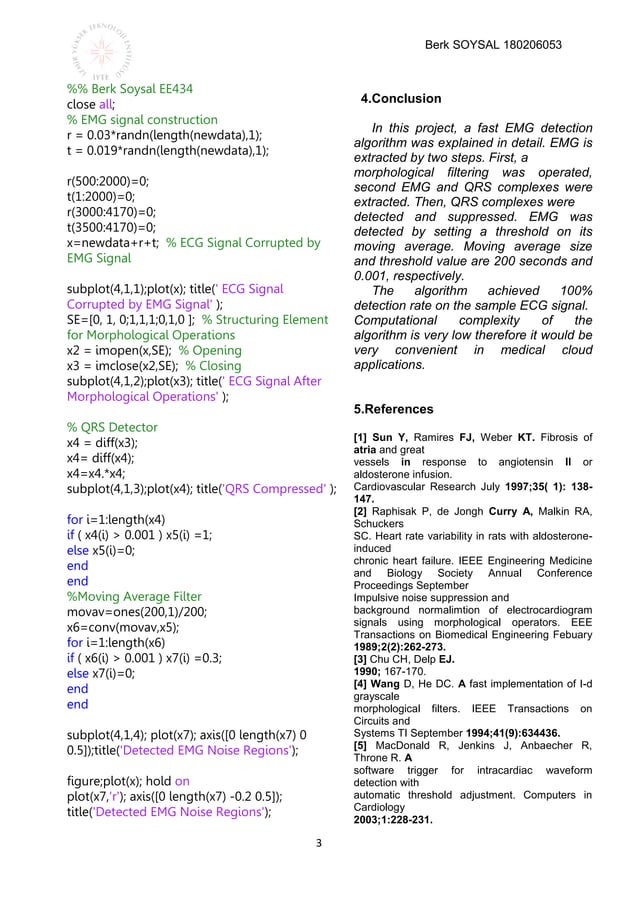 Biomedical project report detecting emg noise | PDF