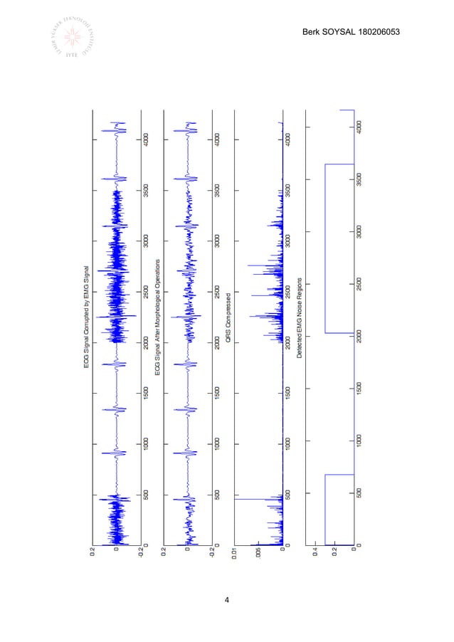 Biomedical project report detecting emg noise | PDF