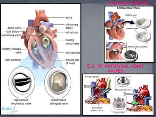 Biomedical Textiles | PPTX