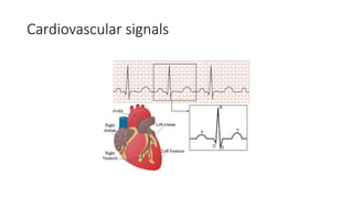 biomedical signal processing and its analysis | PPTX