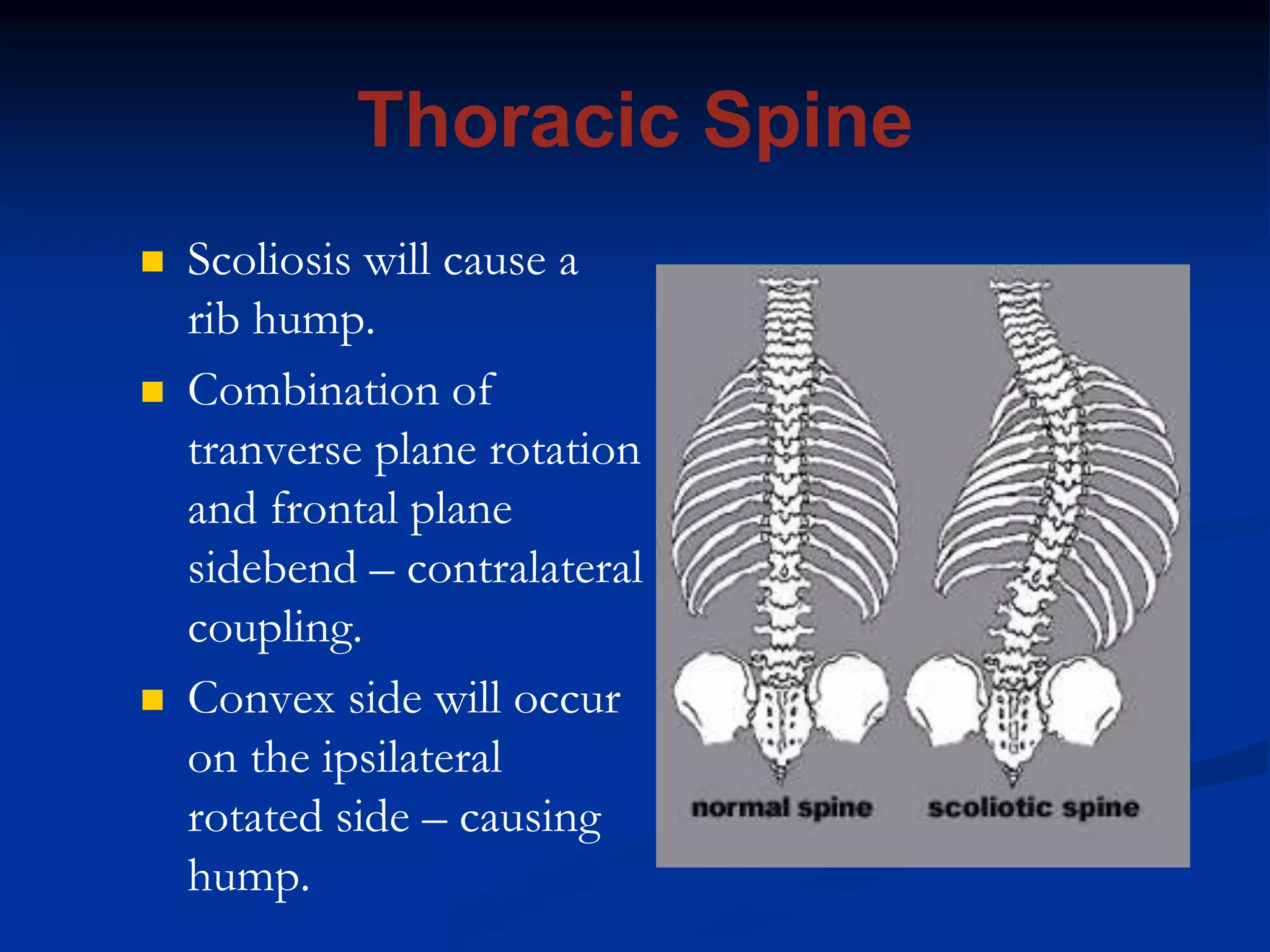 Biomehanics of thoracic spine.ppt