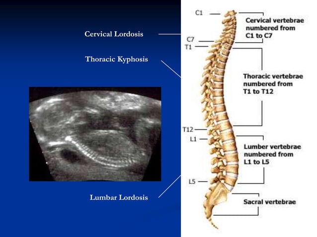 Biomehanics of thoracic spine.ppt | Death, Injury, or Military Conflict ...