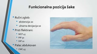 Biomehanika šake | PPTX