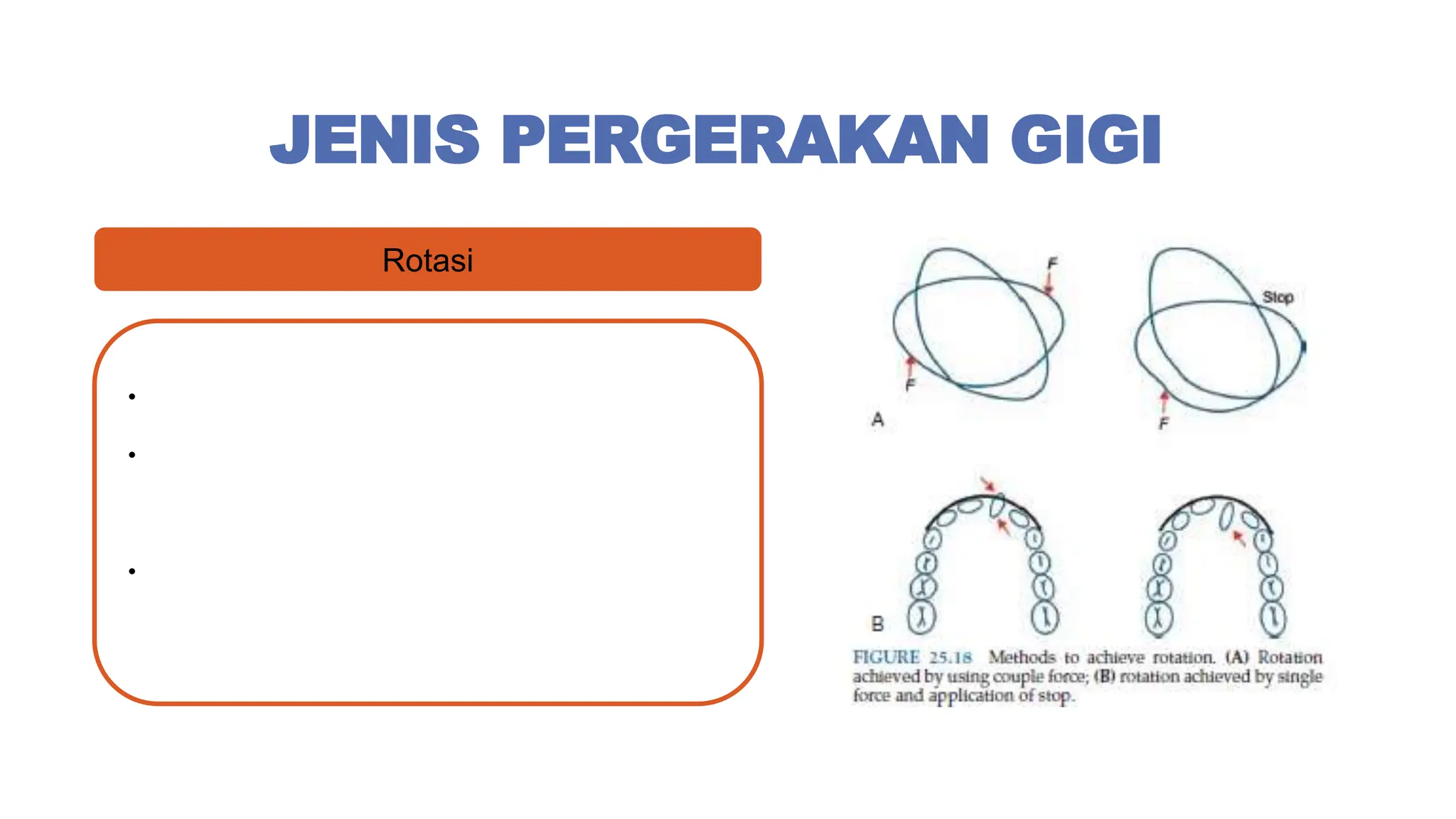 Biomekanik Perawatan Ortodonti pada Sistem Stomatognati | PPTX
