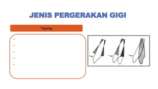 Biomekanik Perawatan Ortodonti pada Sistem Stomatognati | PPTX