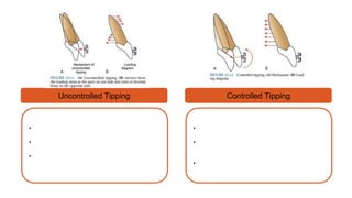 Biomekanik Perawatan Ortodonti pada Sistem Stomatognati | PPTX
