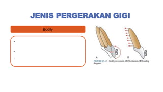 Biomekanik Perawatan Ortodonti pada Sistem Stomatognati | PPTX